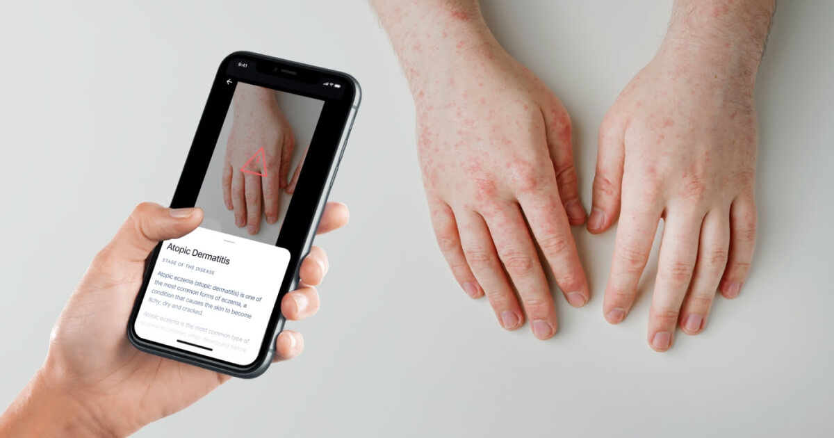 Computer vision-based app for skin disease monitoring | Lemberg Solutions